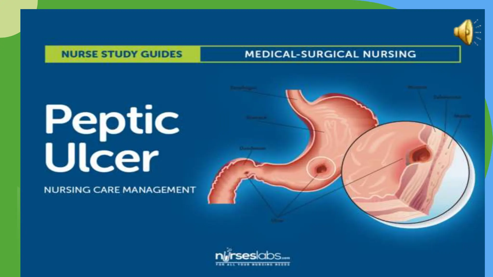 GIT LECTURE 5 Gastritis nursine care.pptx