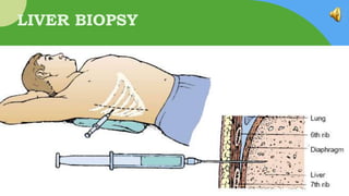 GIT LECTURE 9 liver cirhosis.pptx