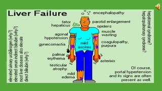 GIT LECTURE 9 liver cirhosis.pptx