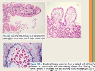 GIT malabsorption. | PPT | Free Download