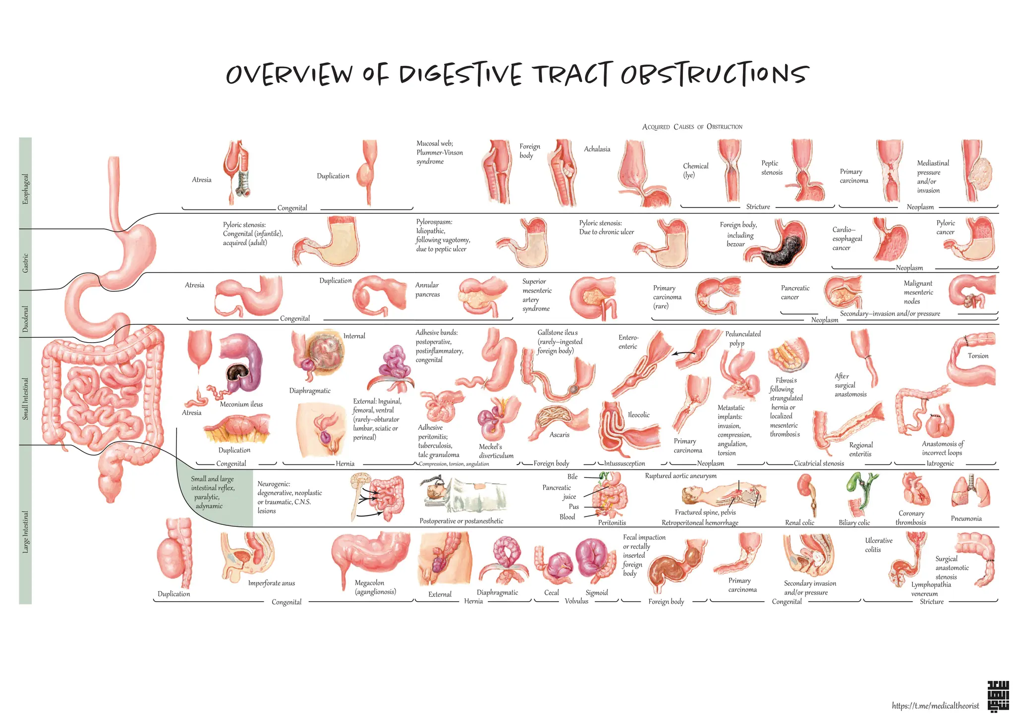 GIT obstructions .pdf clinical presentations | PPT