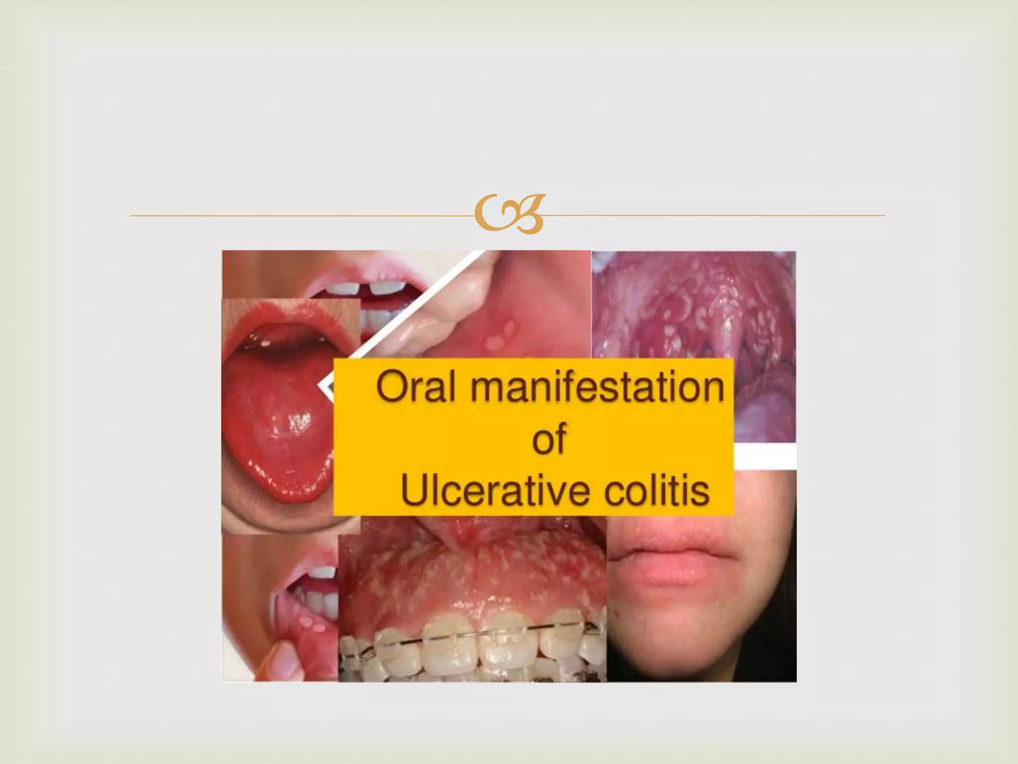 Git oral manifestation | PPTX