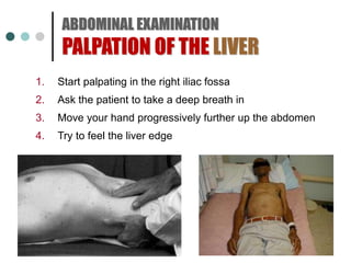 GIT_Physical Examination.ppt