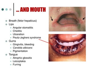 GIT_Physical Examination.ppt