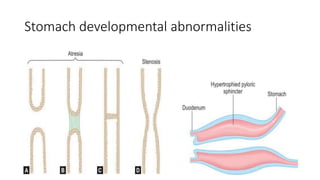 GIT embryology By Dr Parashuram Waddar Pediatrician | PPTX