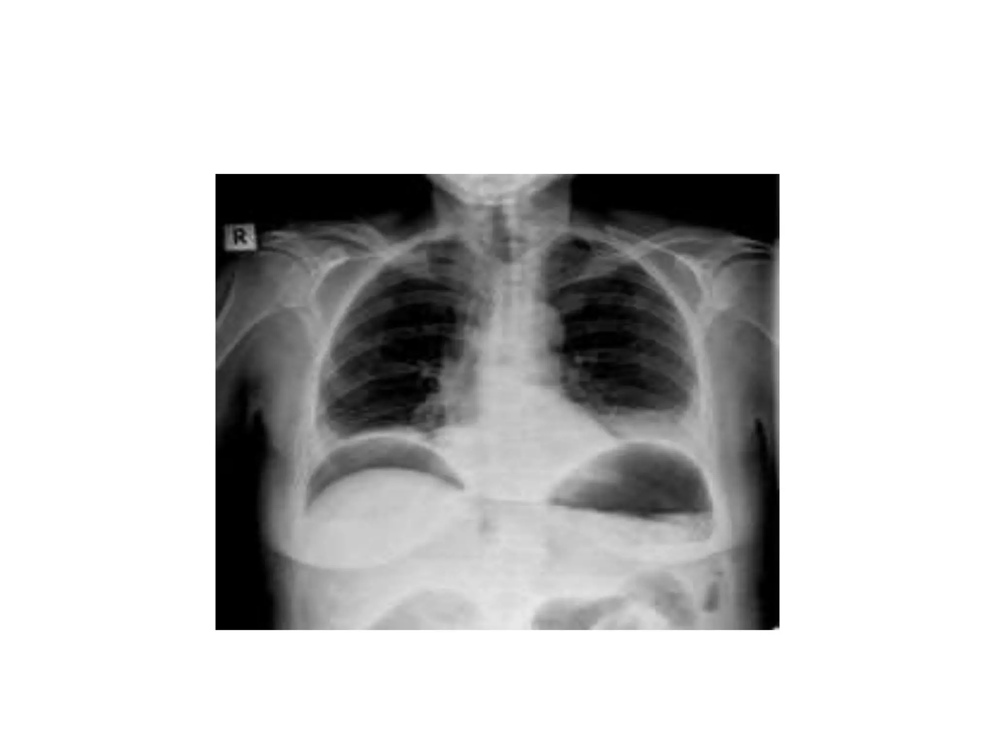 Git radiology | PPTX