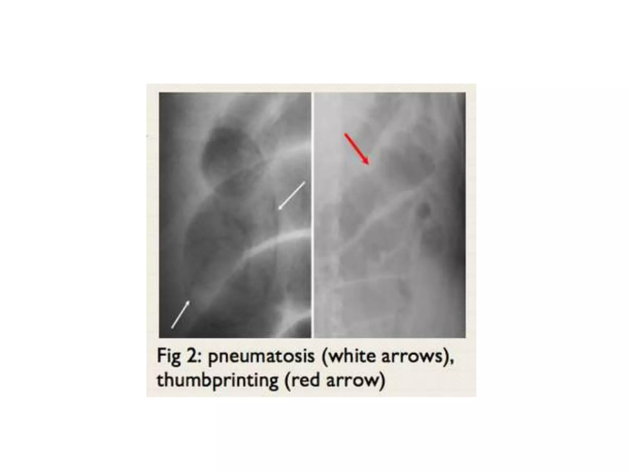 Git radiology | PPTX