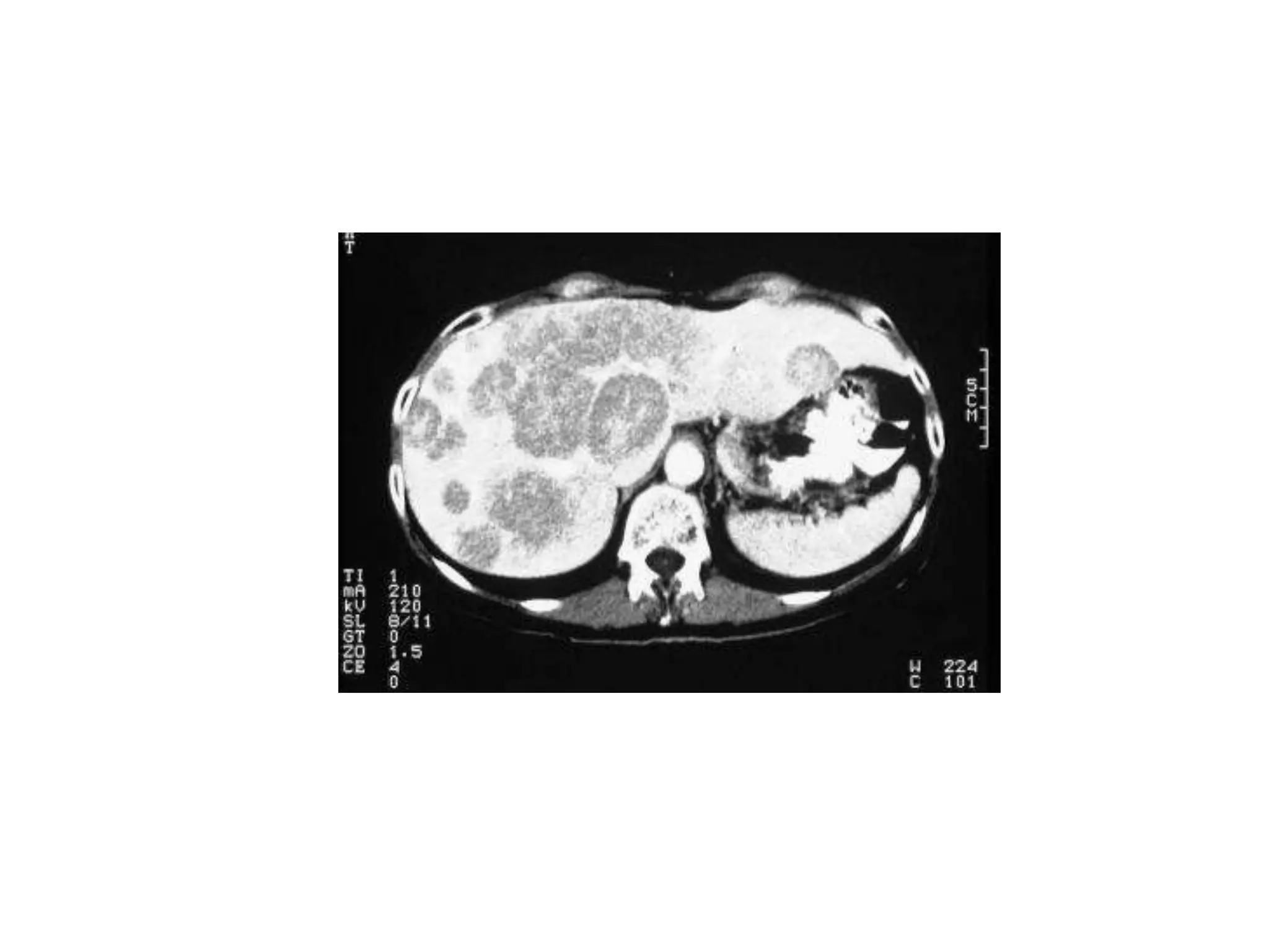 Git radiology | PPTX
