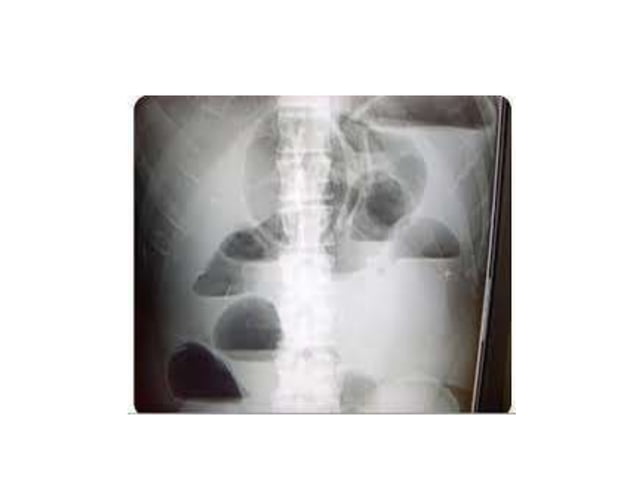 Git radiology | PPTX