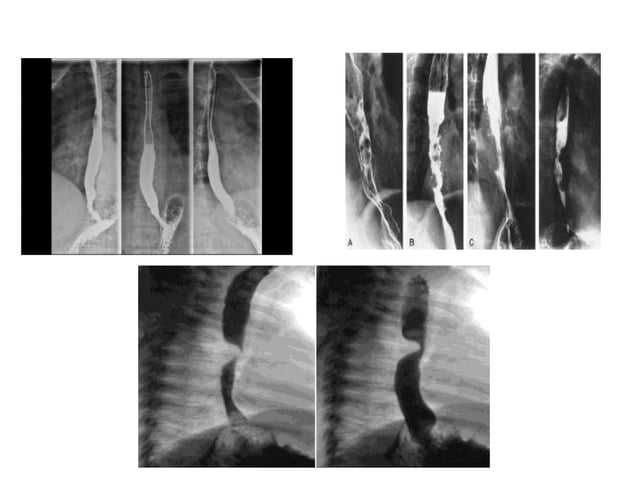 Git radiology | PPTX