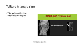 gastrointestinal tract radiology revison notes | PPT