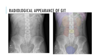 GIT radiology investigation and anatomy.pptx