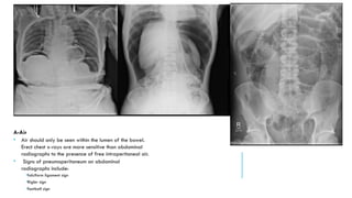 GIT radiology investigation and anatomy.pptx