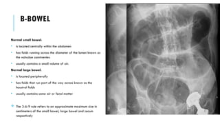 GIT radiology investigation and anatomy.pptx