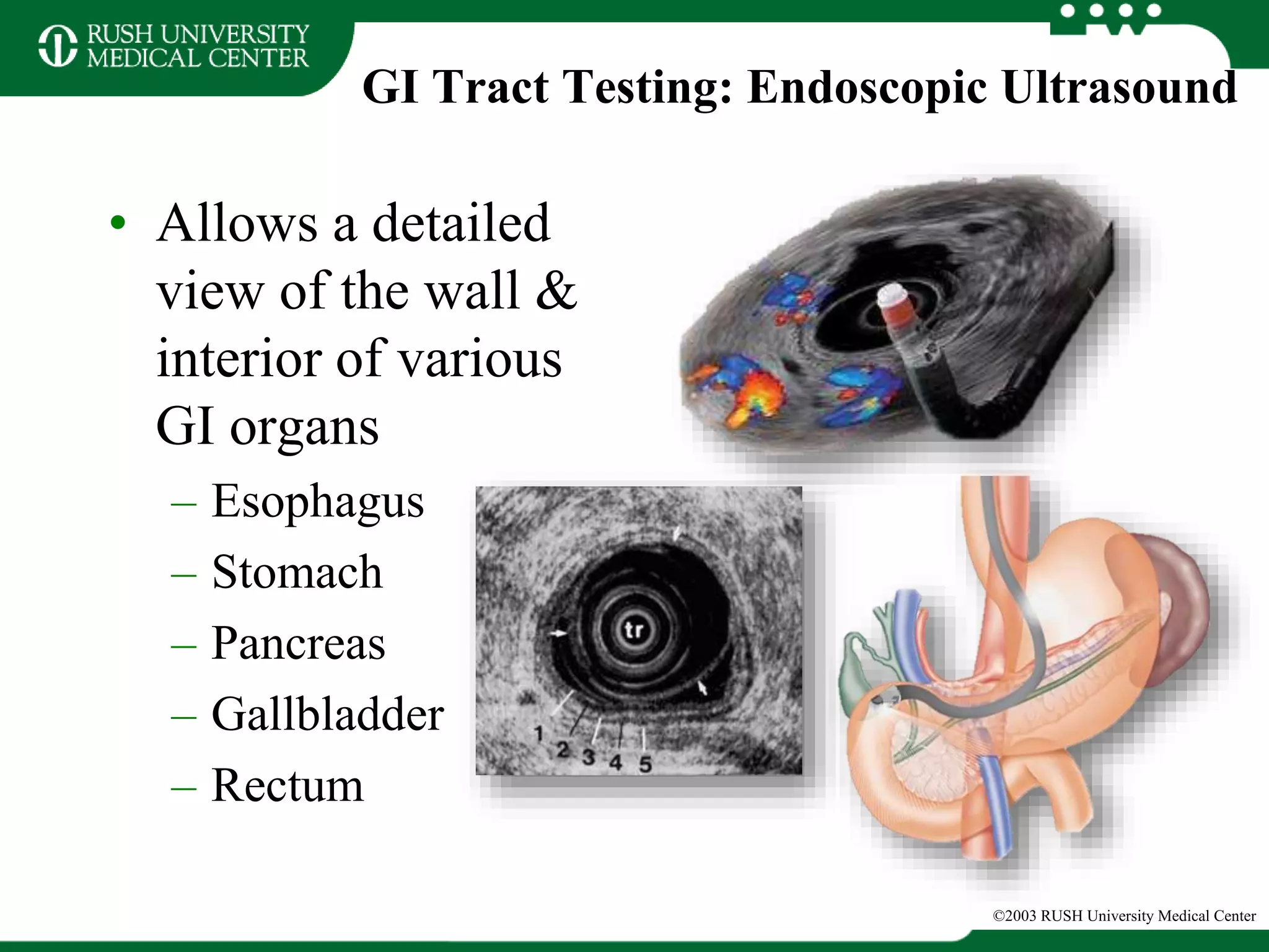 Scleroderma (Systemic Sclerosis) and the GI Tract | PPTX