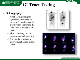 Scleroderma (Systemic Sclerosis) and the GI Tract | PPT