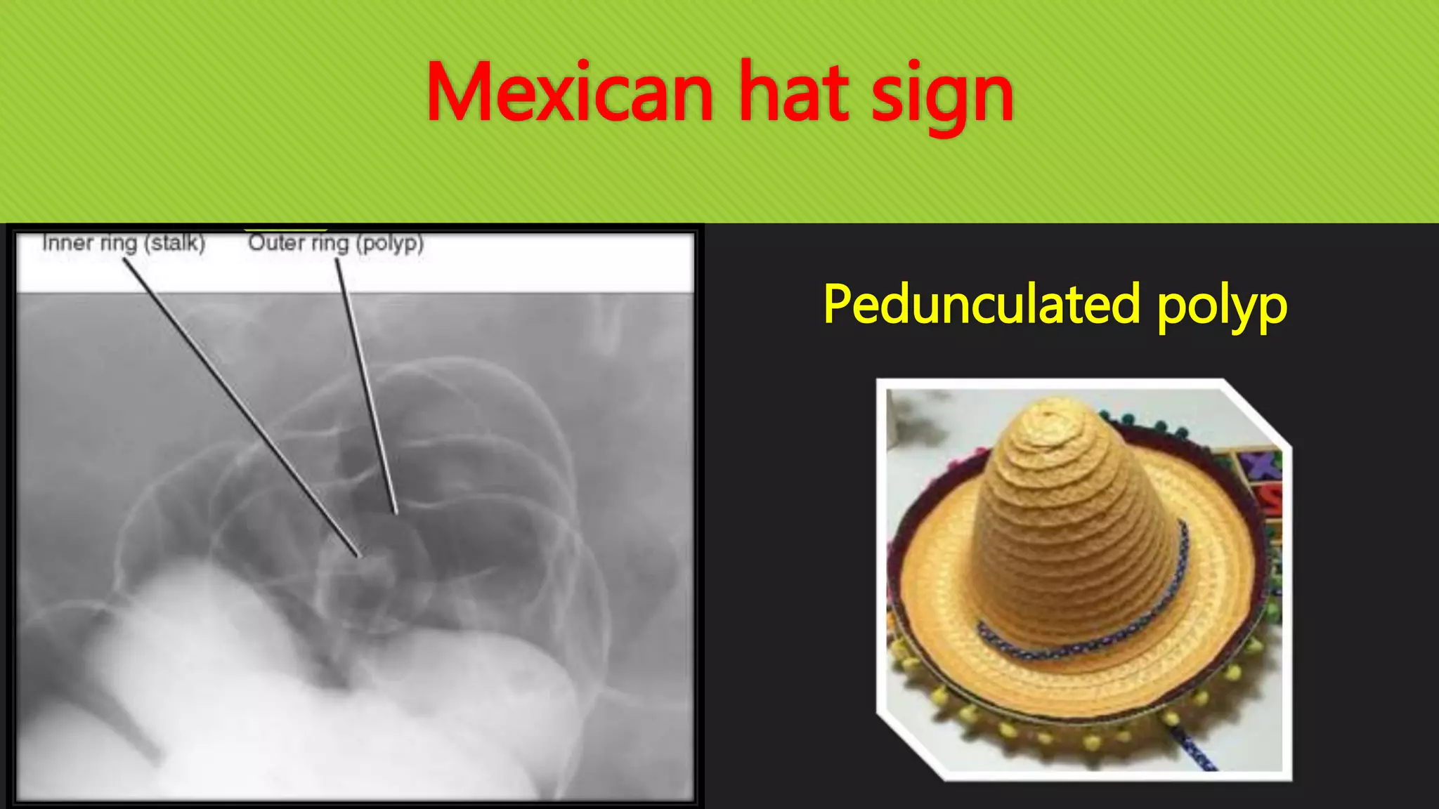 Git signs | PPTX