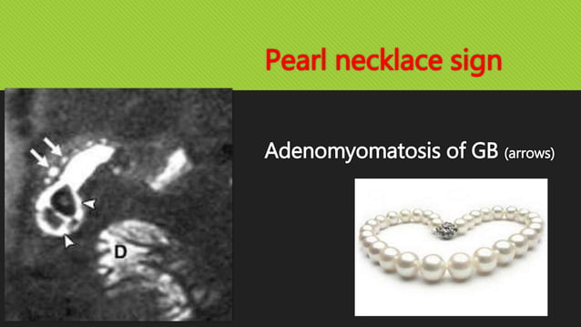 Git signs | PPTX | Digestive Disorders | Diseases and Conditions