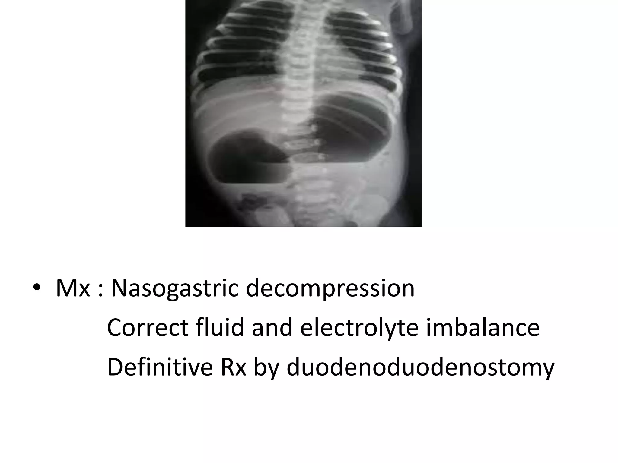 DEVELOPMENT OF GIT AND CONGENITAL ANOMALIES OF GIT | PPTX