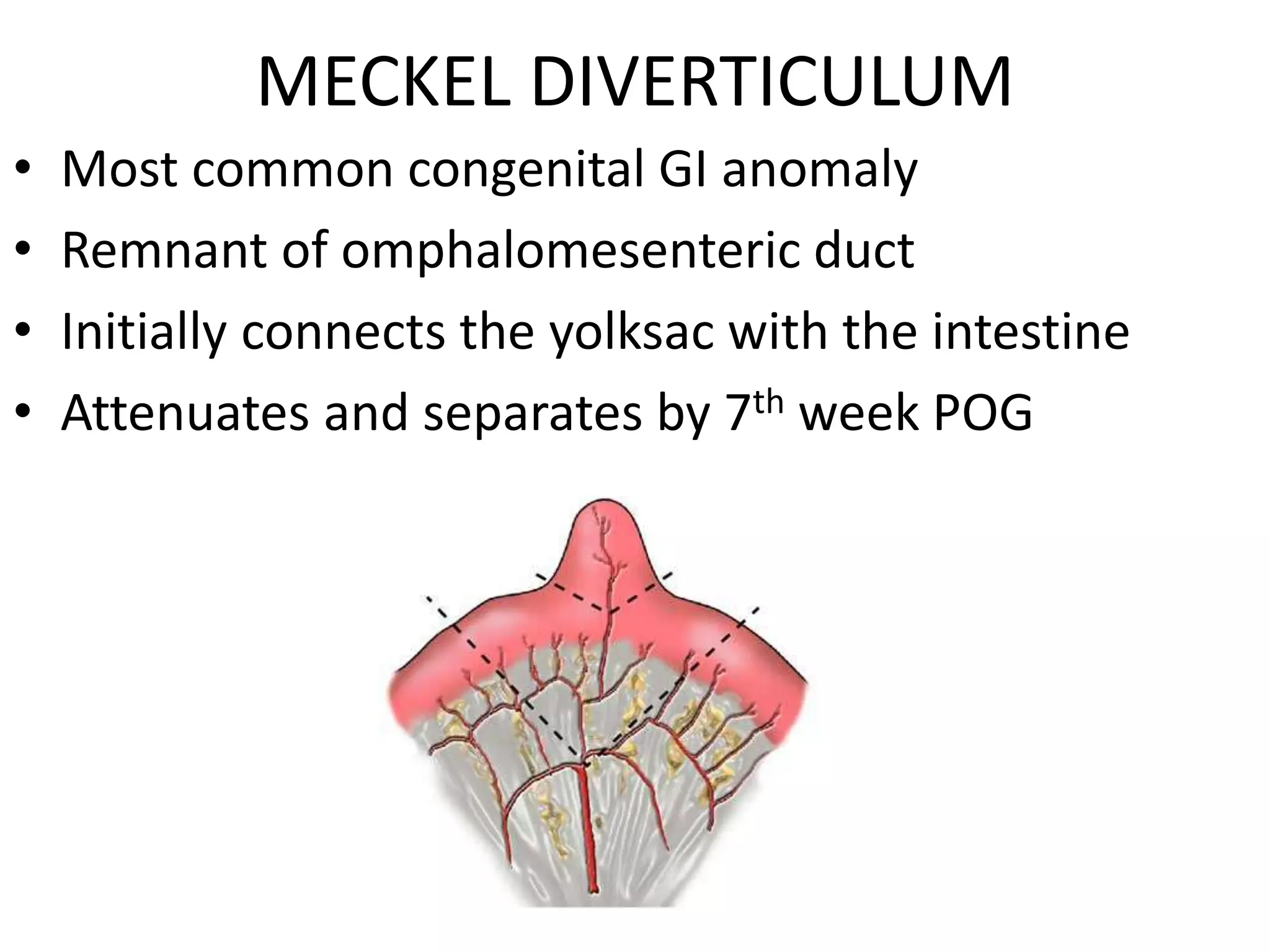 DEVELOPMENT OF GIT AND CONGENITAL ANOMALIES OF GIT | PPTX