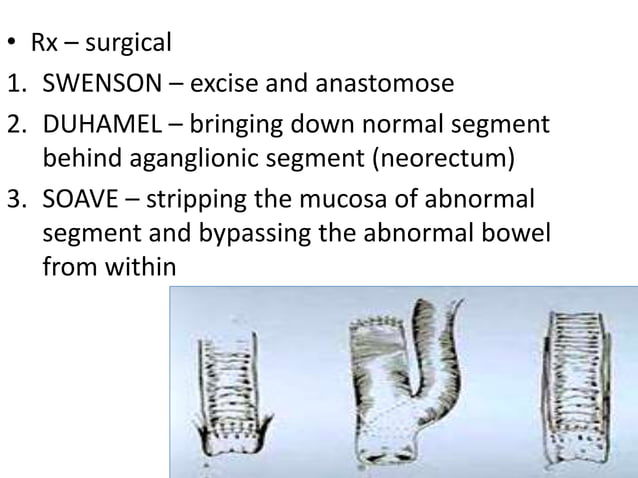 DEVELOPMENT OF GIT AND CONGENITAL ANOMALIES OF GIT | PPTX