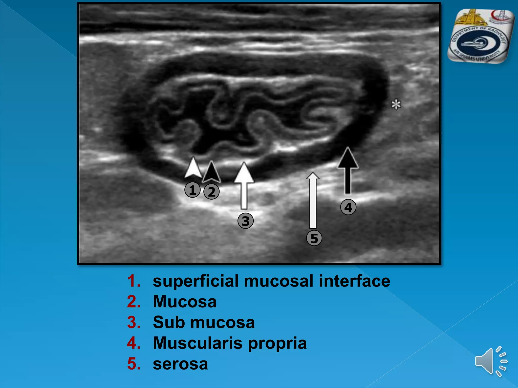 Git ultrasound part I technique & normal appearance | PPT