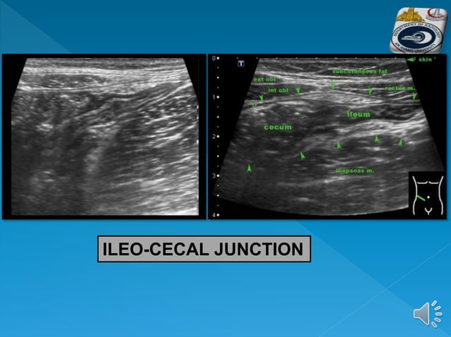 Git ultrasound part I technique & normal appearance | PPT