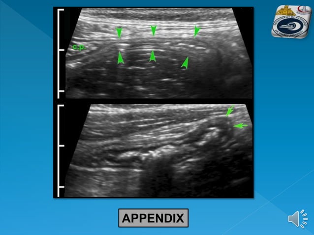 Git ultrasound part I technique & normal appearance | PPT