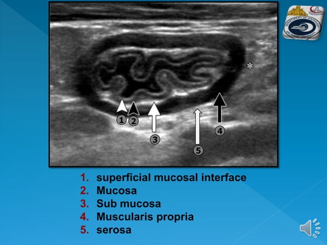 Git ultrasound part I technique & normal appearance | PPT
