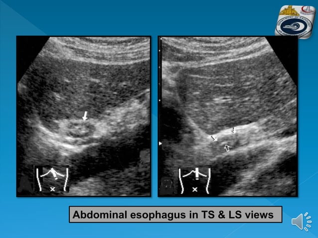 Git ultrasound part I technique & normal appearance | PPT