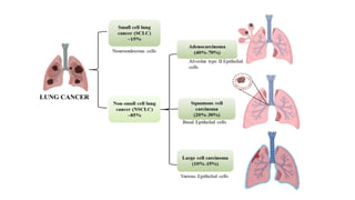 GI, LUNG TUMORS, ADENOMA, ADENOCARCINOMA.pptx