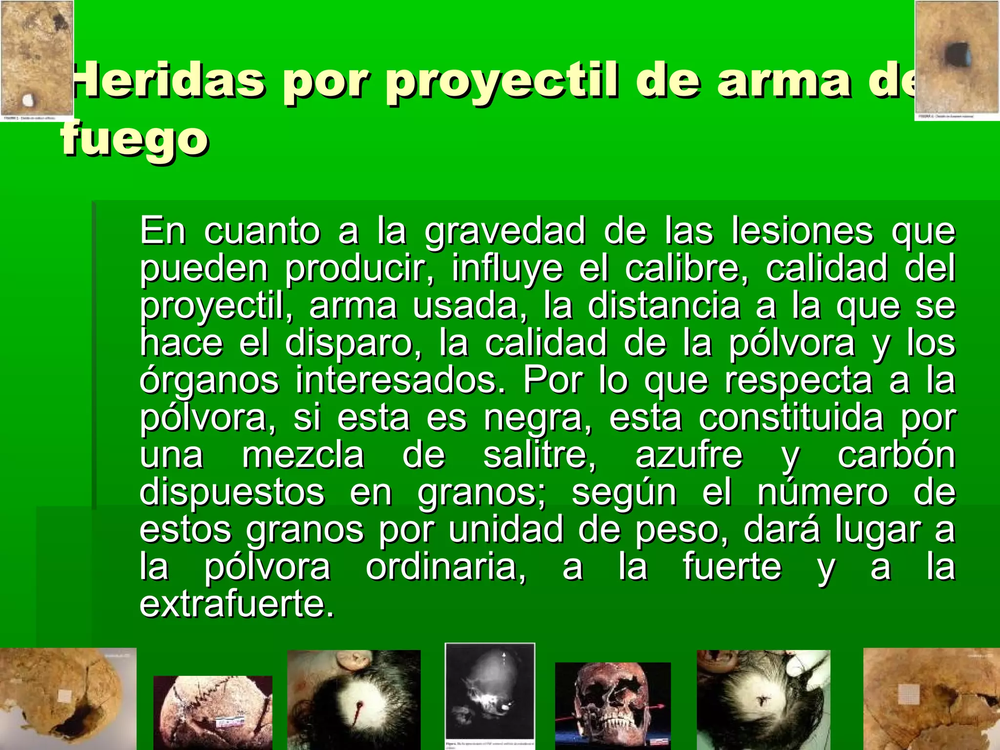 Giuliano bozzo moncada heridas por proyectil de arma de fuego | PPT