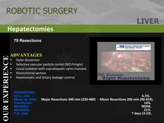 P. Giulianotti - Robotics in General Surgery: State of Art and future perspectives | PPT