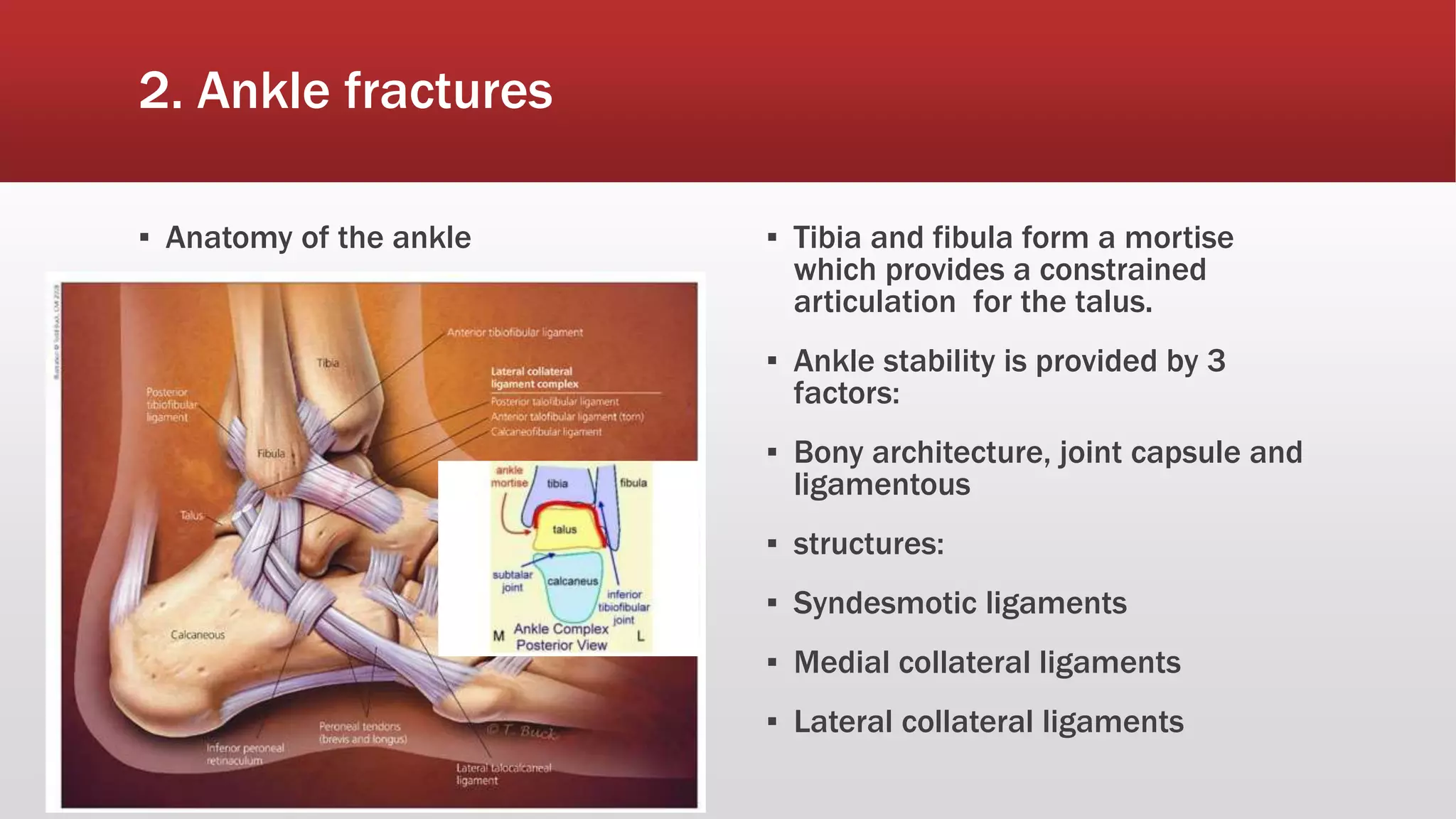 Lower limb fractures-Orthopedics | PPTX