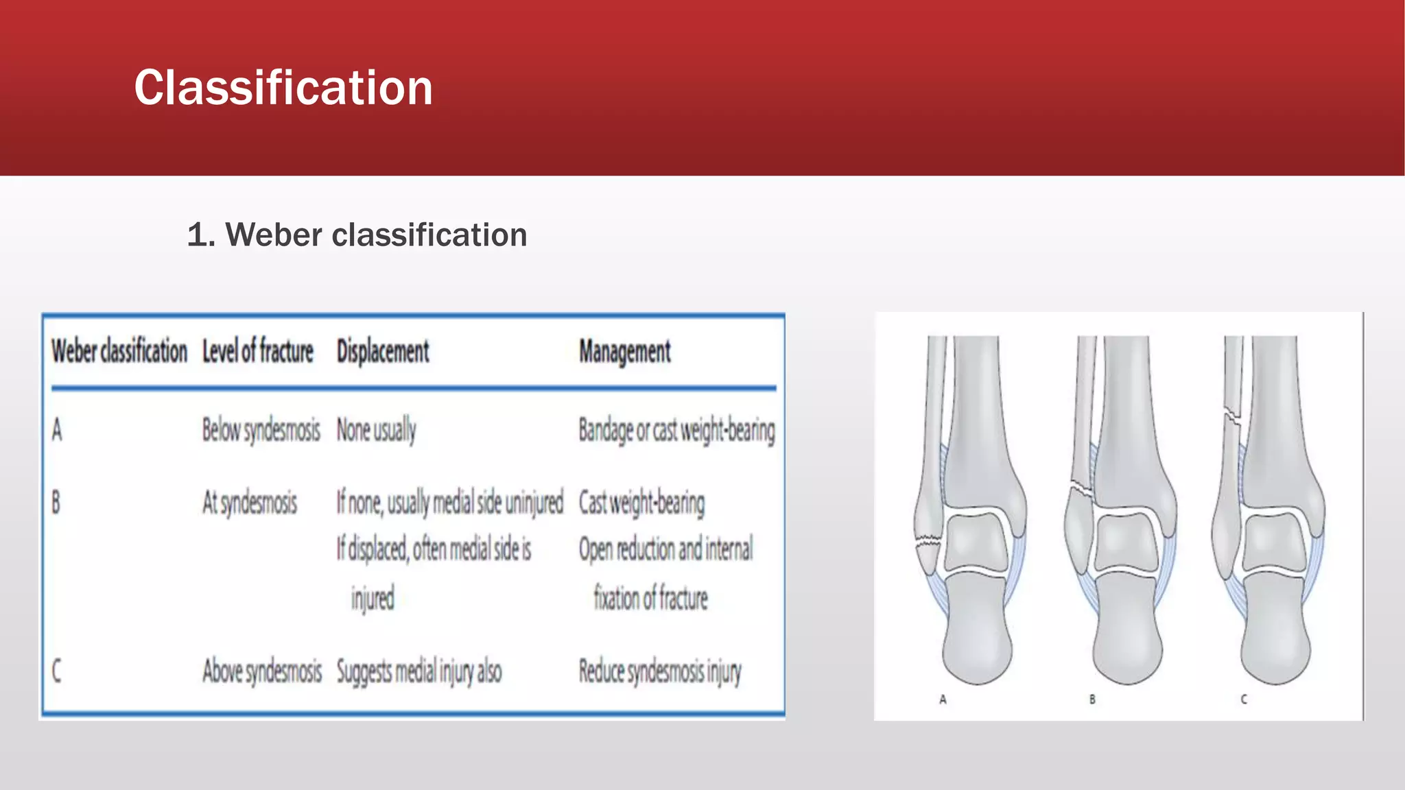 Lower limb fractures-Orthopedics | PPTX