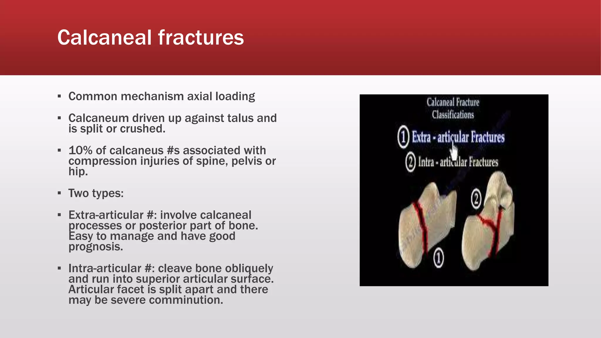 Lower limb fractures-Orthopedics | PPTX
