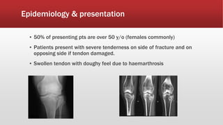Lower limb fractures-Orthopedics | PPTX