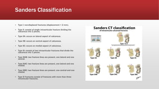 Lower limb fractures-Orthopedics | PPT
