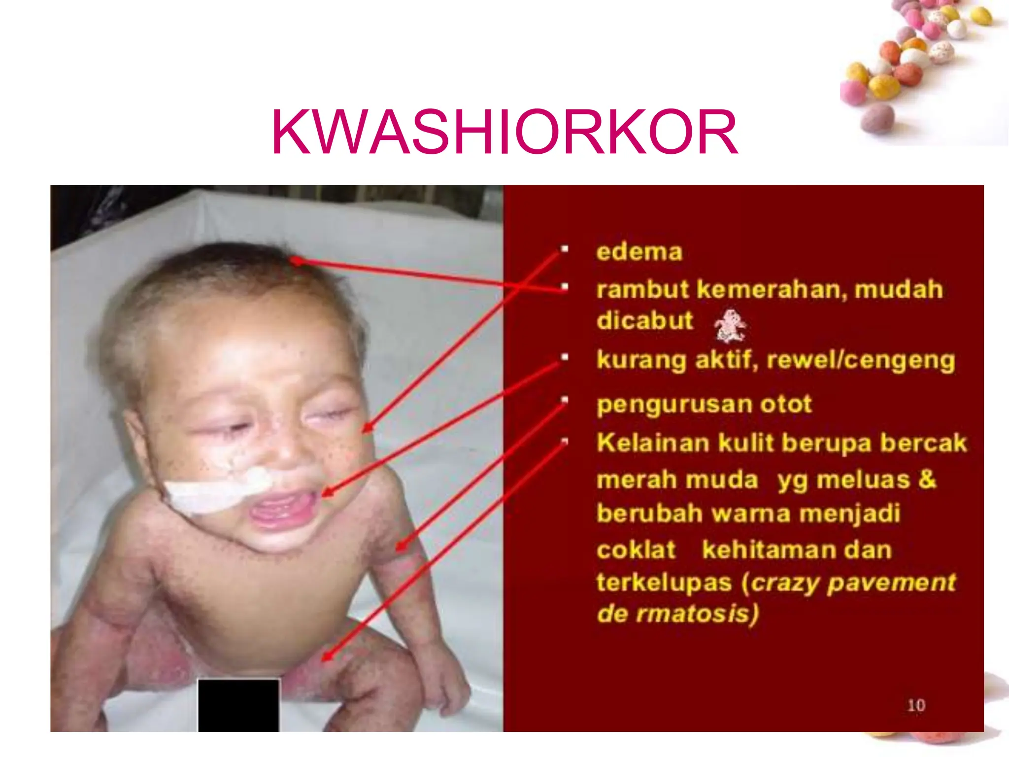 Bahan untuk presentasi Keluarga Sadar Gizi.ppt