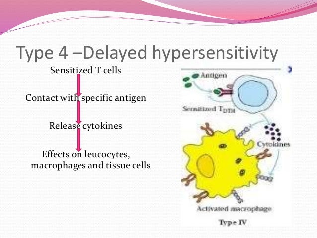 Hypersensitivity
