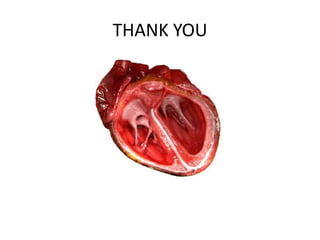 Mitral valve anatomy | PPTX