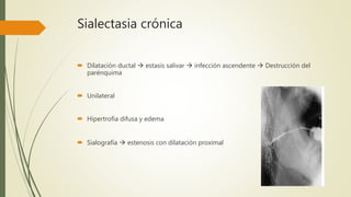 Enf. de glandulas salivales en pediatria | PPTX