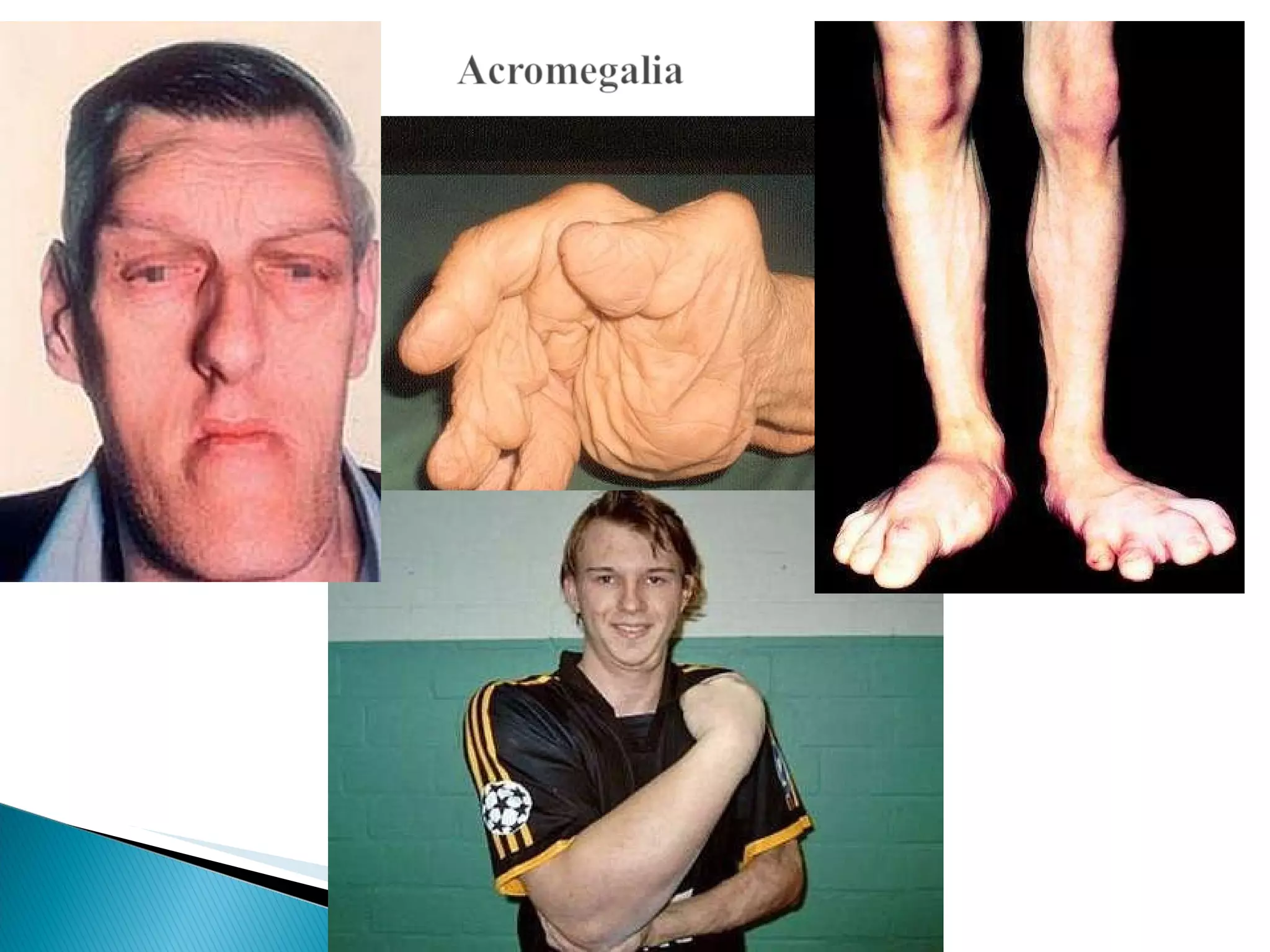 Glandele endocrine | PPT