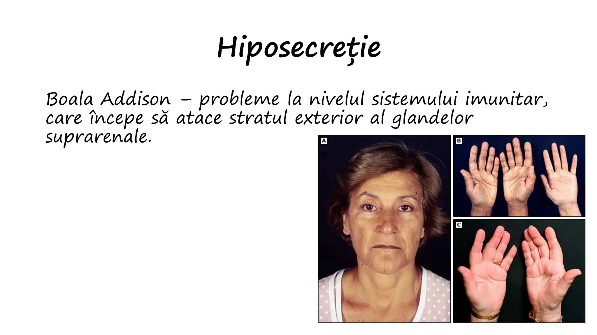 glandele_endocrine_si_hormonii.pptx