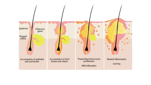 GLANDS IN THE SKIN,FUNCTIONS AND ABNORMALITIES ..pptx
