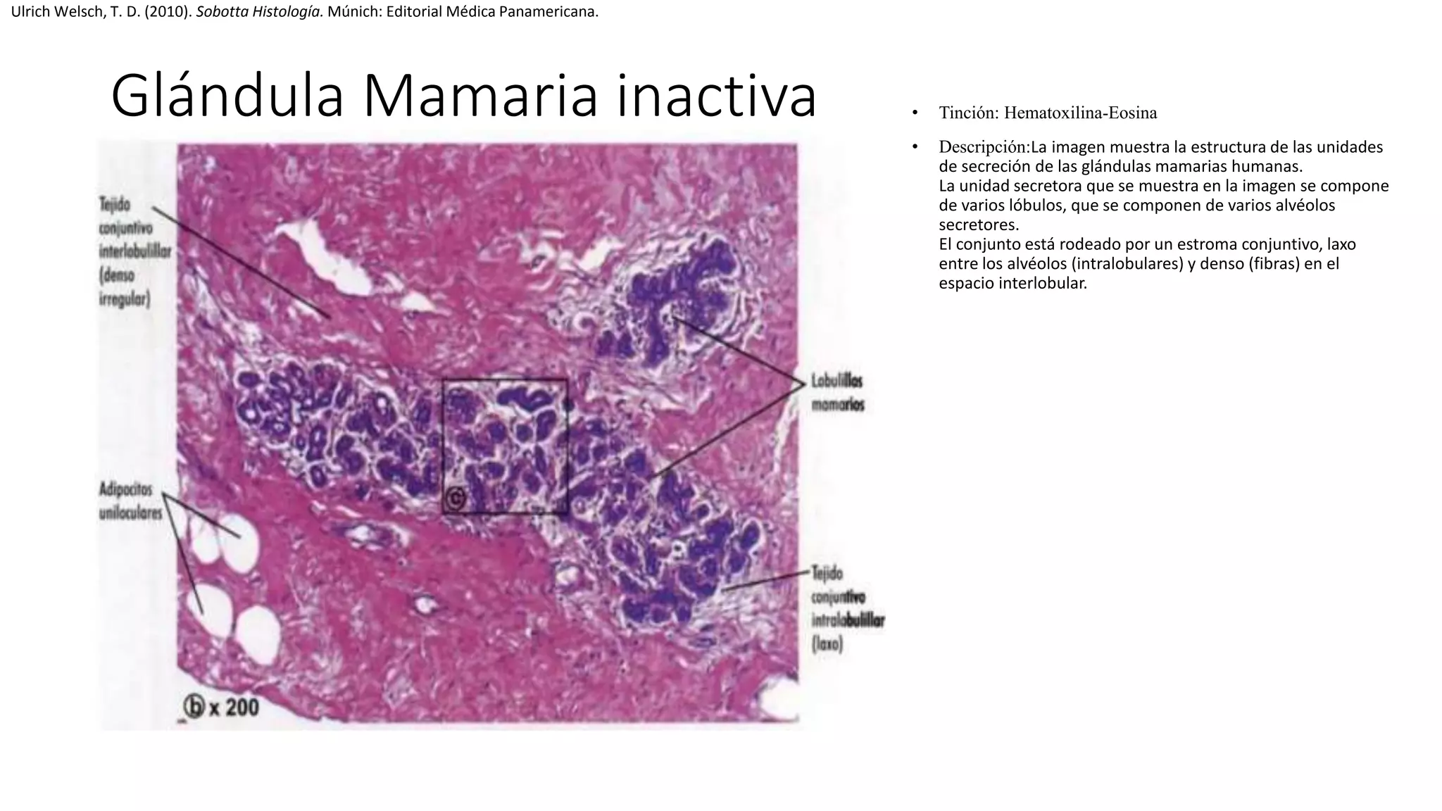 Glandula Mamaria Inactiva Pptx