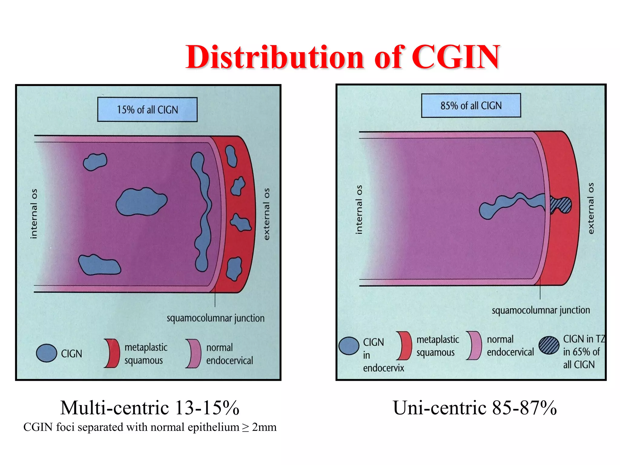 Dr Ayman Ewies - Glandular disease | PDF