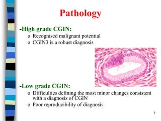 Dr Ayman Ewies - Glandular disease | PDF