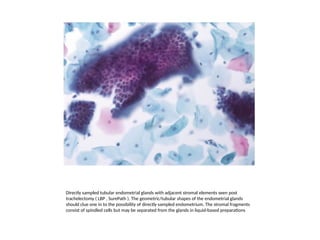 Glandular lesion of cervix in pap smear. | PPTX