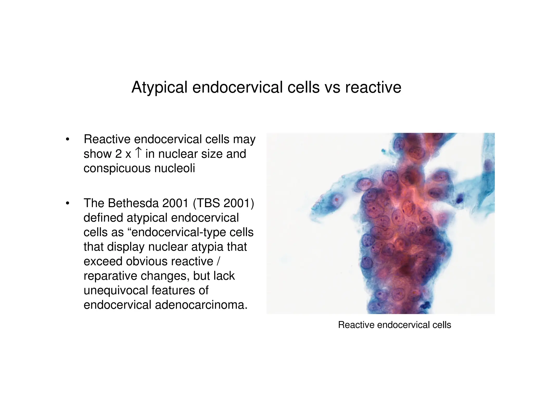 GLANDULAR LESIONS CYTOLOGY IN CERVICAL CYTOLOGY.pdf